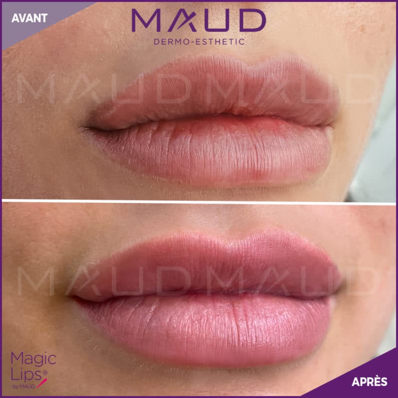 Maquillage Permanent Sourcils avant/après Magic Lips - MAUD