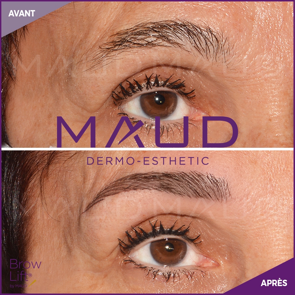 Brow Lift Avant / Après | Maquillage Permanent Sourcils | MAUD